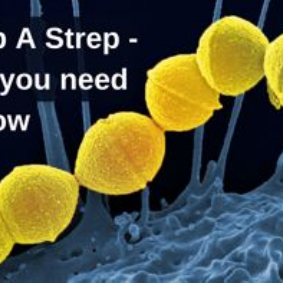 Holgate Primary and Nursery - Group A Strep: Useful Information